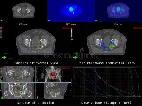 Pelvic Sections Stock Illustrations 26 Pelvic Sections Stock