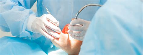 Osseous Surgery Sugar Land Texas 77479 Smiles On Greatwood