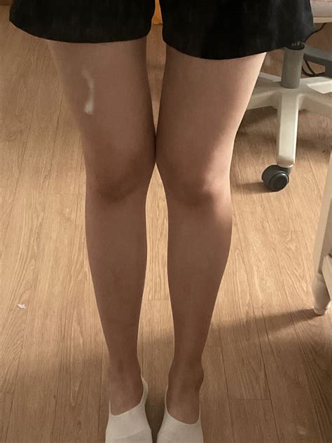 자유수다 발목이 너무 얇아서 강남언니 1등 성형수술and피부시술 정보앱