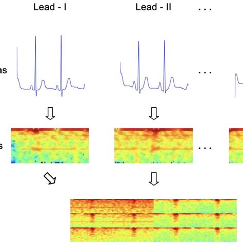 Examples Of Ecg Waveforms Top Row And Their Corresponding Download Scientific Diagram