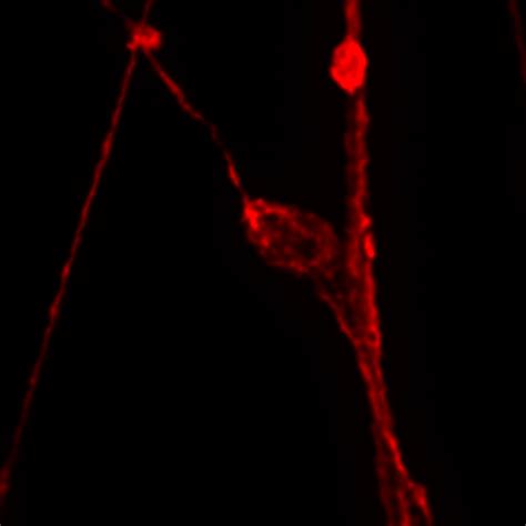 Axonal Regeneration In Motor Neurons Derived From Human Ipscs Crestoptics
