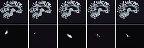 The Hippocampus Segmentation Result A Fcn Segmentation B Unet