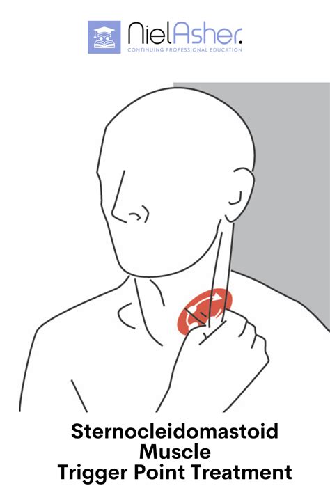 Serratus Anterior Muscle Self Help Trigger Point Treatment Artofit