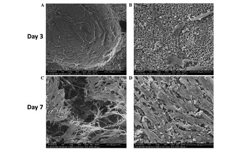 Characterization Of Human Periodontal Ligament Cells Cultured On Three Dimensional Biphasic