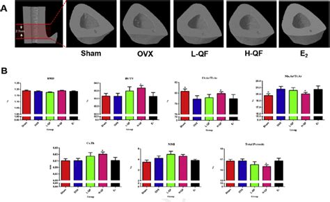 micro ct based cortical bone region of interest and representative