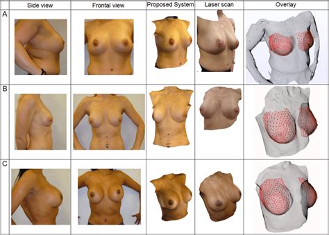 Composite Figure Sets Showing From Left To Right Patient Photographs Download Scientific