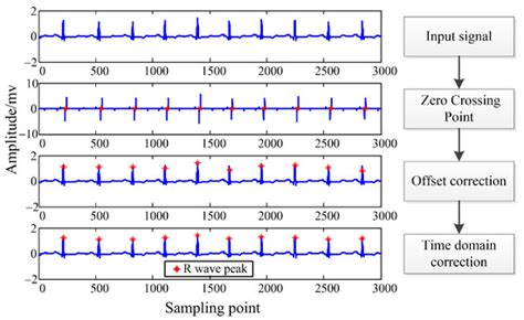 The Identification Of Ecg Signals Using Wavelet Transform And Woa Pnn