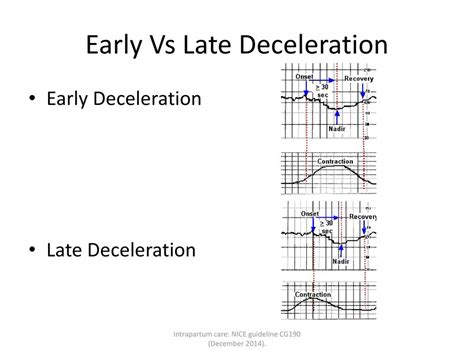 How To Read A Ctg Dr Pradeep S Dr Sabitha Us Ppt Download