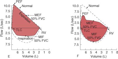 Airflow Lung Volumes And Flow Volume Loop Tests Of Pulmonary Function PFT Merck Manual