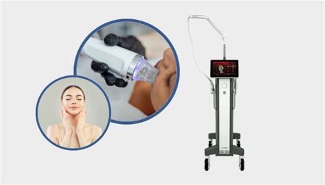 Experience The Cutting Edge Benefits Of Secret RF Microneedling