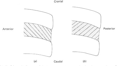 Figure 1 From Collagen Organisation In The Interspinous Ligament And Its Relationship To Tissue