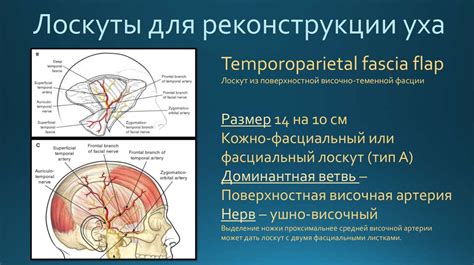 Лоскуты в пластической хирургии головы и шеи - online presentation