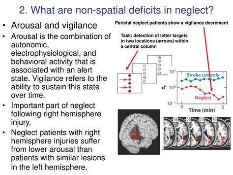 Ppt Spatial Neglect And Attention Networks Powerpoint Presentation Free Download Id3385267