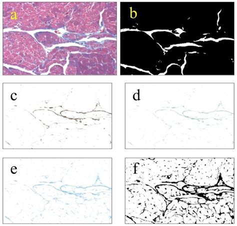 Figure S3 Methodology Used For Measuring Collagen Collagen Was Download Scientific Diagram