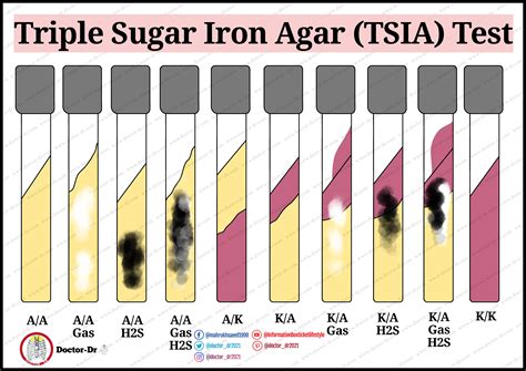 Best 13 Triple Sugar Iron Tsi Agar Principle Results And Interpretation Artofit