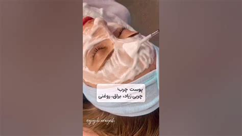 مشخصات تشخیص انواع پوست😍🍓 Skincare پوست Skincareroutine دختر جوش