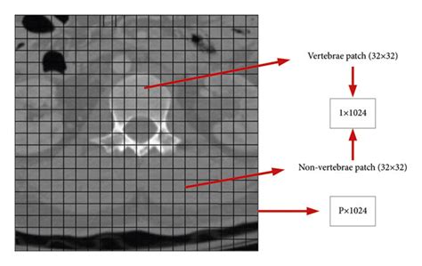 Illustration Of The Pe Module An Example Image Demonstrates The Patch Download Scientific