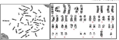 Figure 1 From Automated Karyotyping Of Metaphase Cells With Touching Chromosomes Semantic Scholar