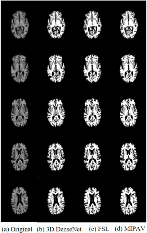 figure 8 from deep learning based diagnosis algorithm for alzheimer s