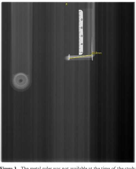Figure 3 From Human Examination And Artificial Intelligence In Cephalometric Landmark Detection