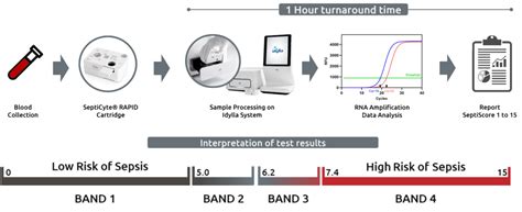 Sepsis Test Shows The Value Of Rapid Diagnosis Clinical Lab Products