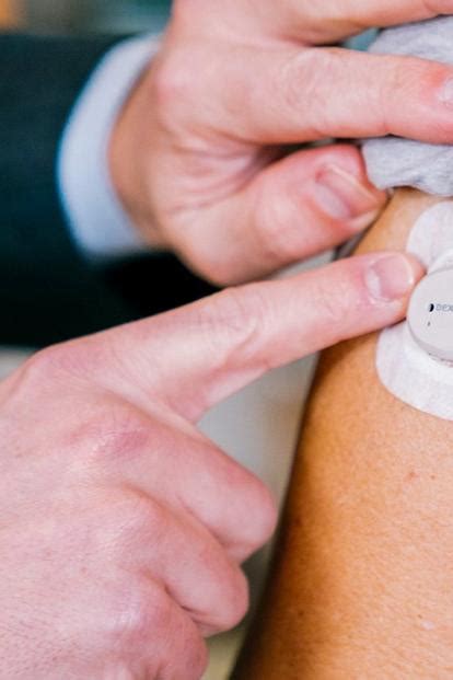 Diabetes Skin Care And Patch Adhesion Dexcom Dexcom