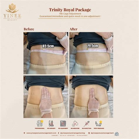 Keeping Your Rib Cage Yinee Posture Management Singapore