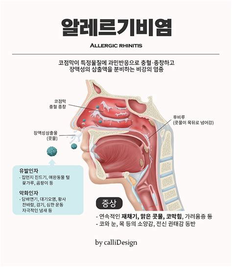 전주 소아 알레르기비염 축농증 콧물 한의원
