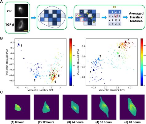 Haralick Features Quantify Vimentin Texture A Flowchart Of