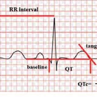 The QT Interval Starts At The Onset Of The Q Wave And Ends Where The Download Scientific