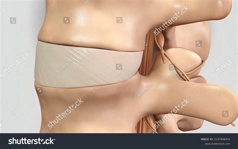 Nerve Compression Syndrome Compression Neuropathy Medical Stock