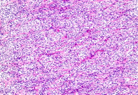 You Are Being Redirected