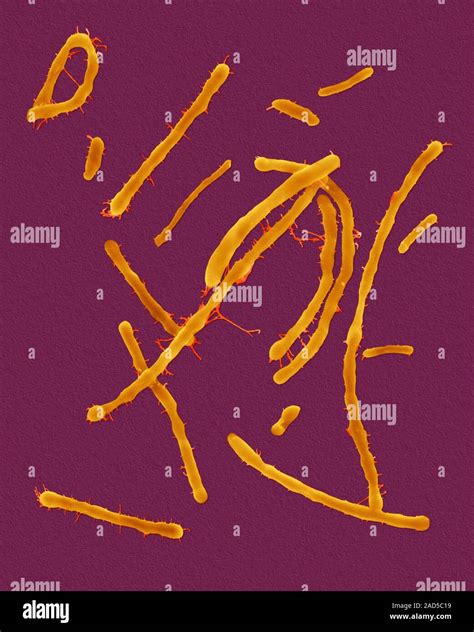 Coloured Scanning Electron Micrograph Sem Of Halobacterium Sp Is A Halophilic Archaea