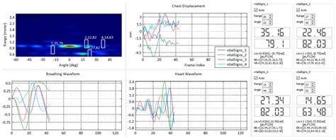 Human Vital Signs Detection A Concurrent Detection Approach
