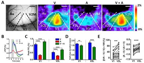 Flavoprotein Imaging Of Visual And Cross Modal Auditory Response In Download Scientific Diagram