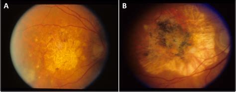 Deepseenet A Deep Learning Framework For Classifying Patient Based Age