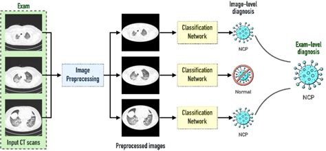 overview of our pipeline an input ct scan is preprocessed to remove