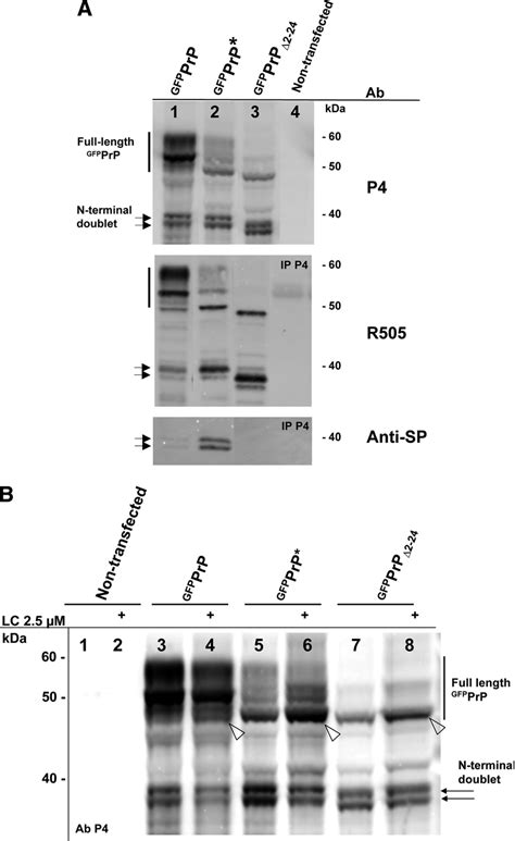 Sheep Gfp Prp Variants In Mouse Neuroblastoma Cells A The Sheep Gfp