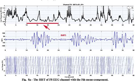 Figure 1 From Hilbert Huang Transform Used For Eeg Signal Analysis