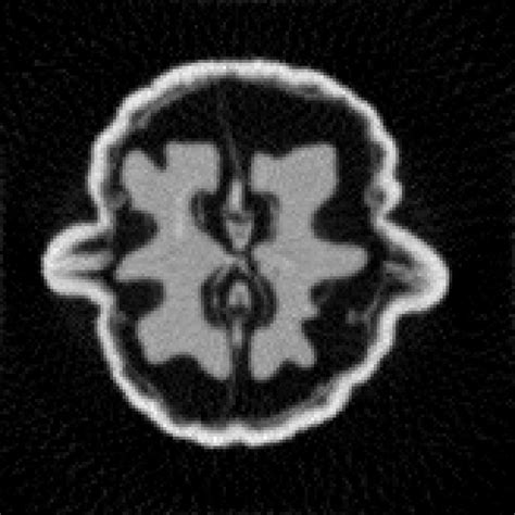 Walnut Test Problem A High Quality Reconstruction Download Scientific Diagram