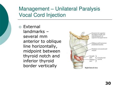 Ppt Vocal Cord Paralysis Medialization Laryngoplasty Powerpoint