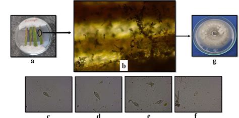 Isolation Of M Oryzae Following Spore Drop Technique A Leaves Download Scientific Diagram