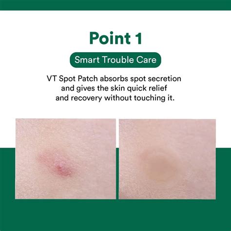 Vt Cica Spot Patch Buy Online