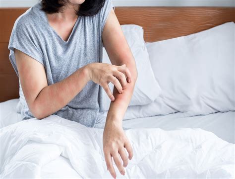 Summer Travel Guide Steering Clear Of Bed Bug Hotspots