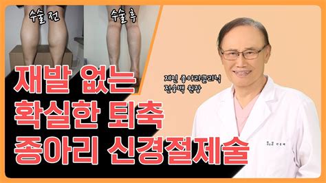 제인 종아리클리닉 종아리퇴축술종아리알 종아리 알빼기 의학적으로 확인된 종아리알 확실하게빼는법 Youtube