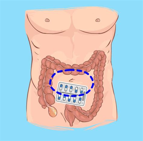3 Etapas De La Apendicitis Que Deberías Saber Reconocer Genial