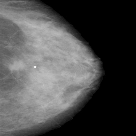 Python Numpy Ndarray Image Pixel Mean For Pixel Values Greater Than Zero Normalizing Image