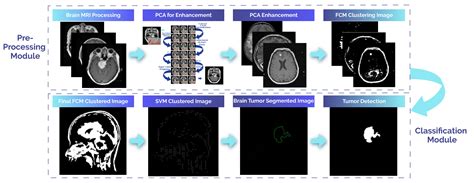 Cmes Contrast Normalization Strategies In Brain Tumor Imaging From