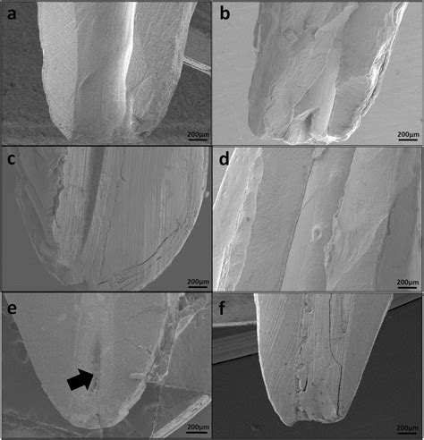Sem Shows The Process Of Obturating The Apical Area Of The Root Canal