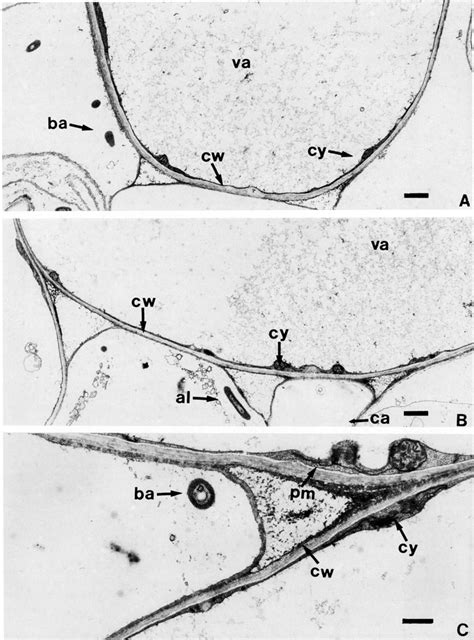 A C Parts Of Rhizodermal Cells Of The Iron Deficient Rm 57 Root